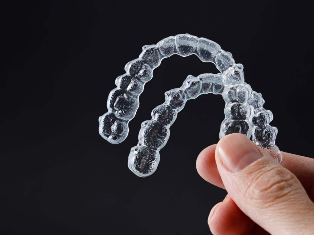 Mitos e verdades: O aparelho Invisalign funciona?